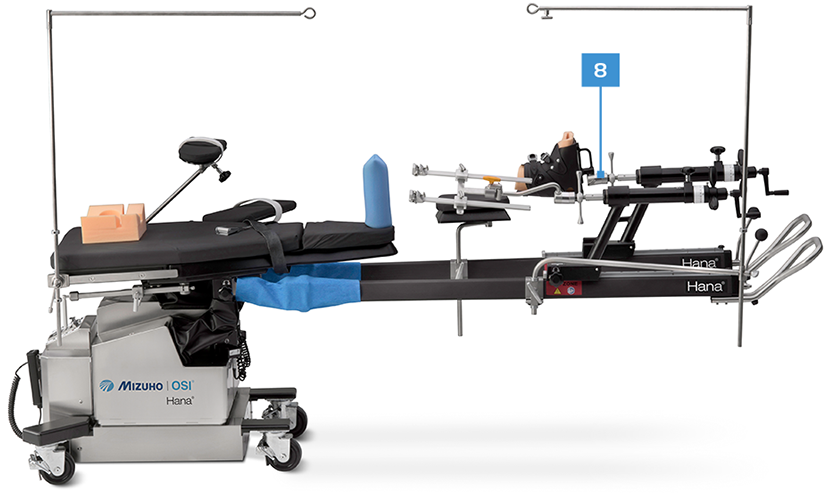 Hana® Im Femoral Nailing Unilateral Skeletal Traction Mizuho Osi