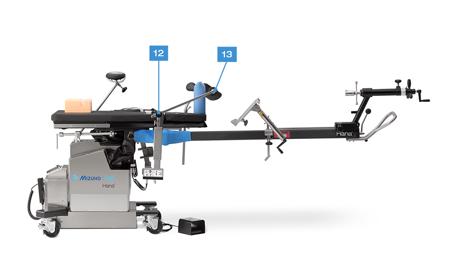 Hana Retrograde IM Femoral Nailing: Supine with Unilateral Skin Traction